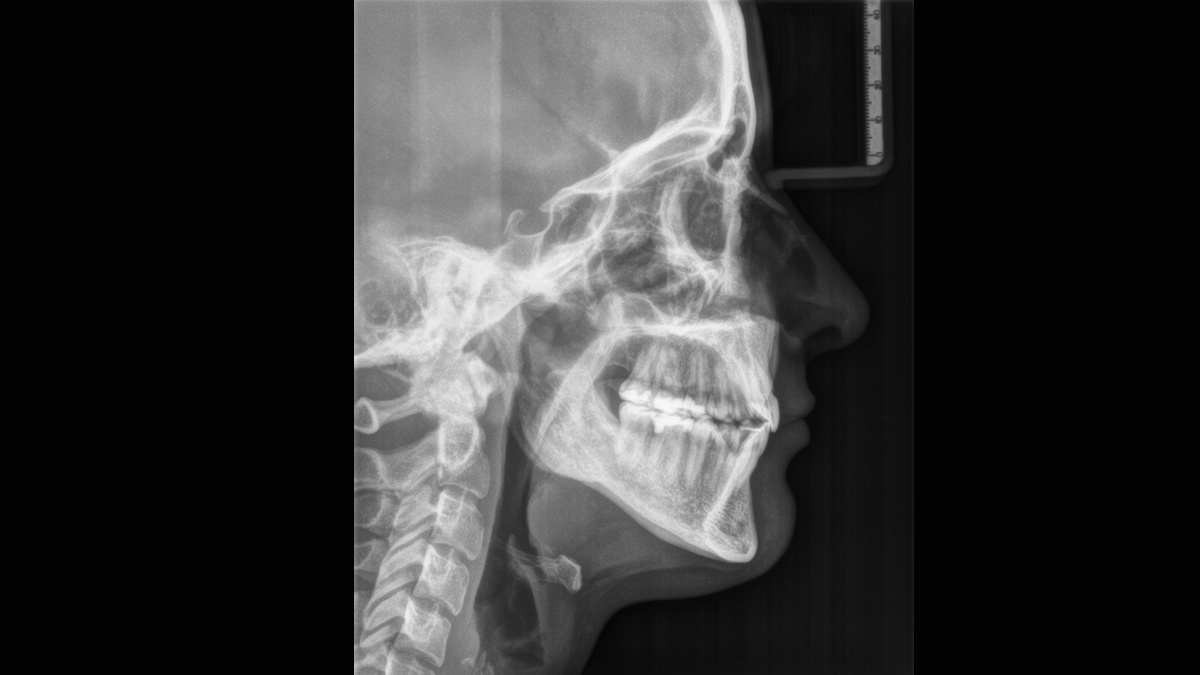 Technology in Concord, MA | Concord Children's Dental Associates